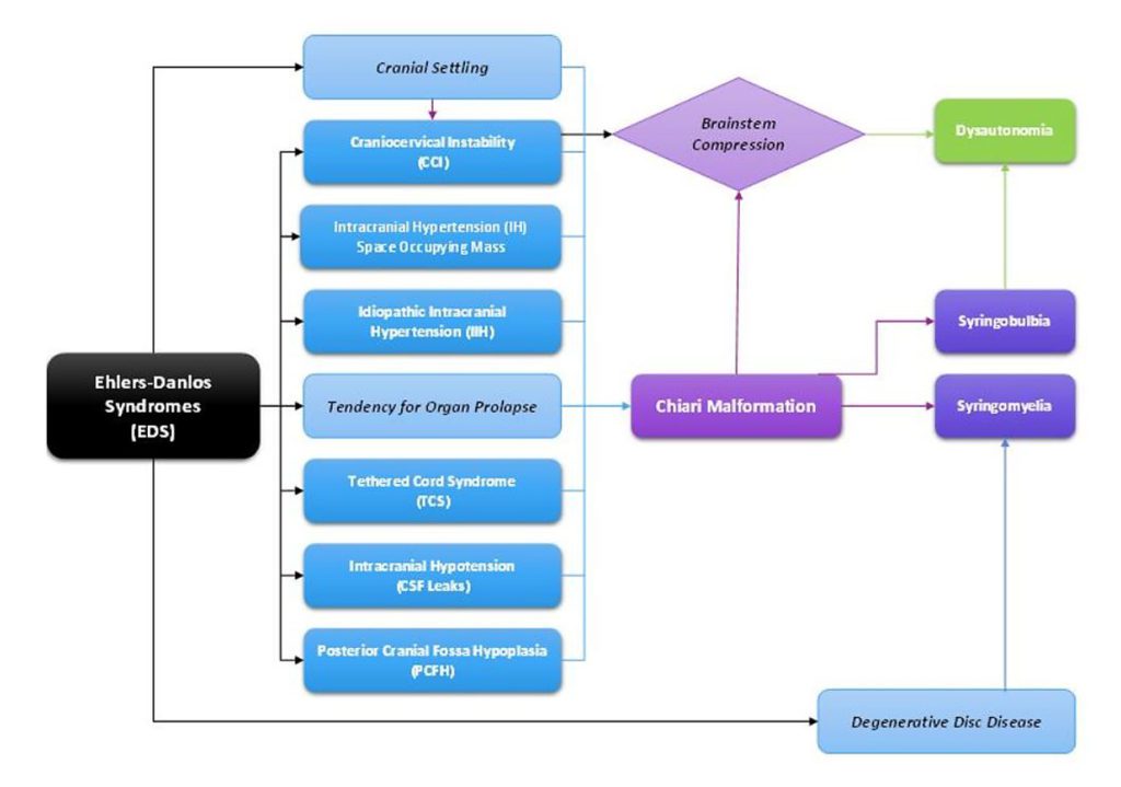 Degenerative Disc Disease Archives - Chiari Bridges