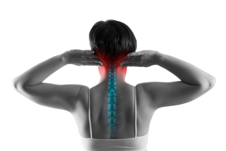 Understanding Your Head and Neck Pain - Chiari Bridges