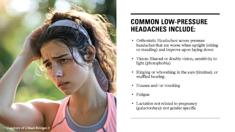 Understanding Your Head and Neck Pain - Chiari Bridges