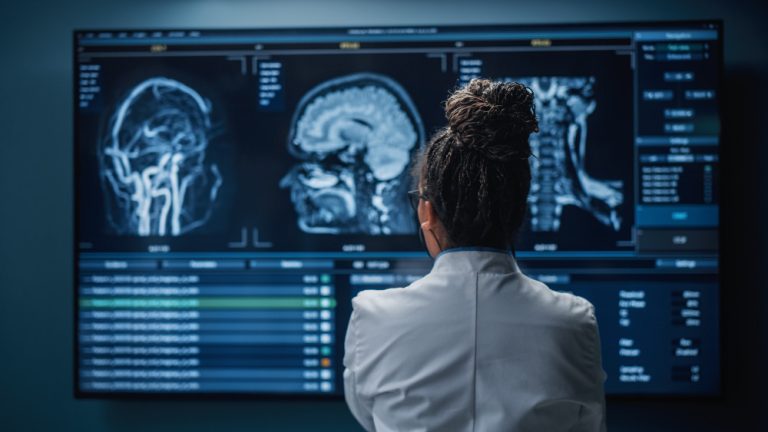 The Important Questions to Ask Your Neurosurgeon [Revised] - Chiari Bridges