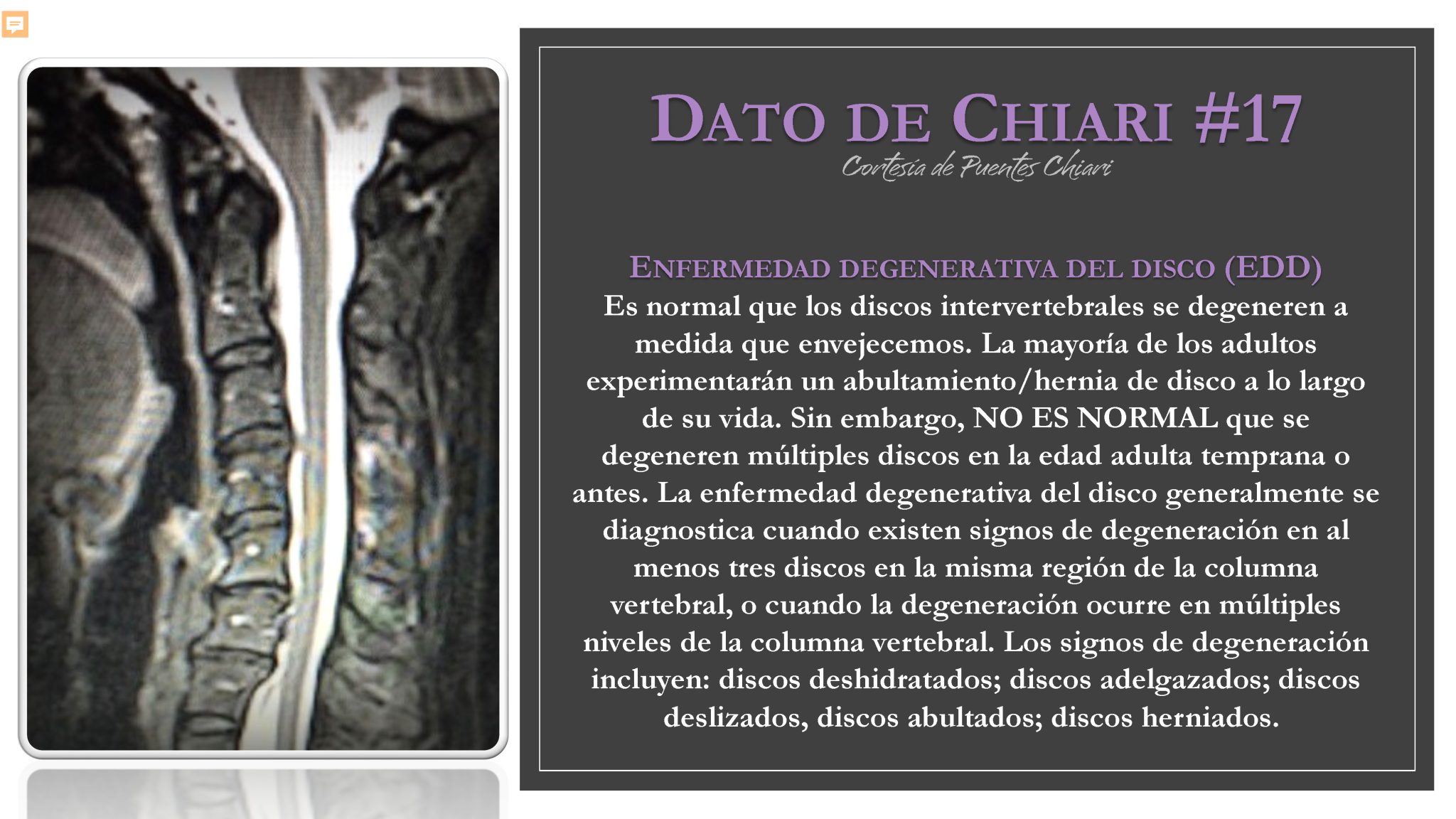 Dato de Chiari #17 - Chiari Bridges